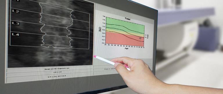 A Guide to Bone Density Testing | BodySpec