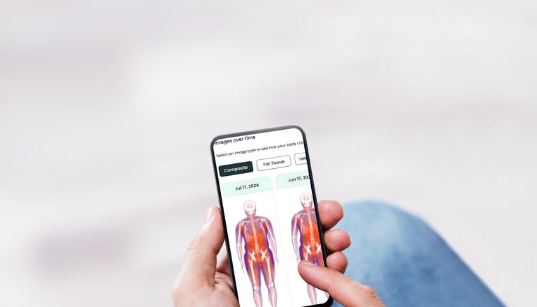 Where to Get a DEXA Scan in Chicago, IL | Full Body Scans Near You ...